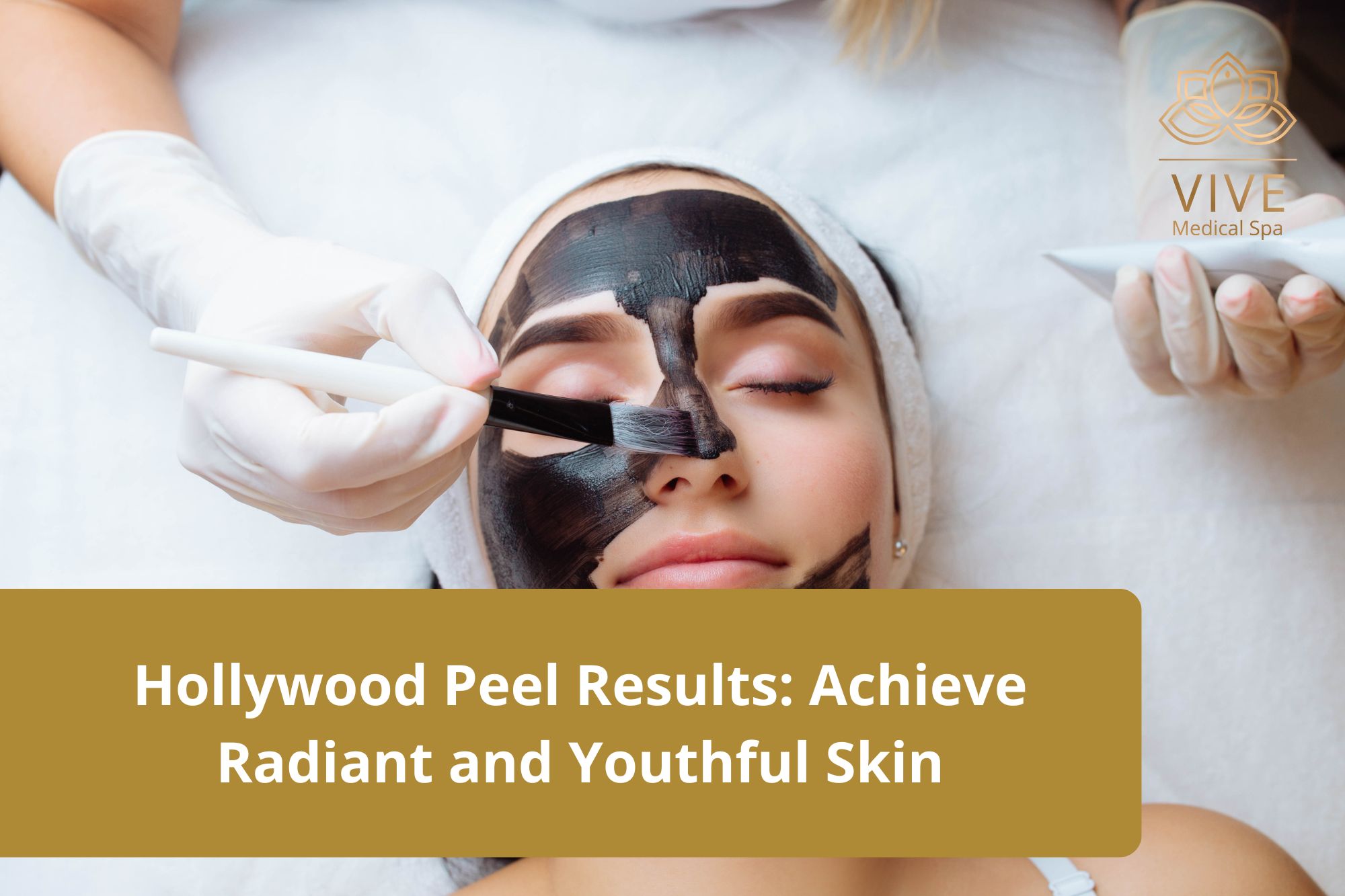 Hollywood Peel Results