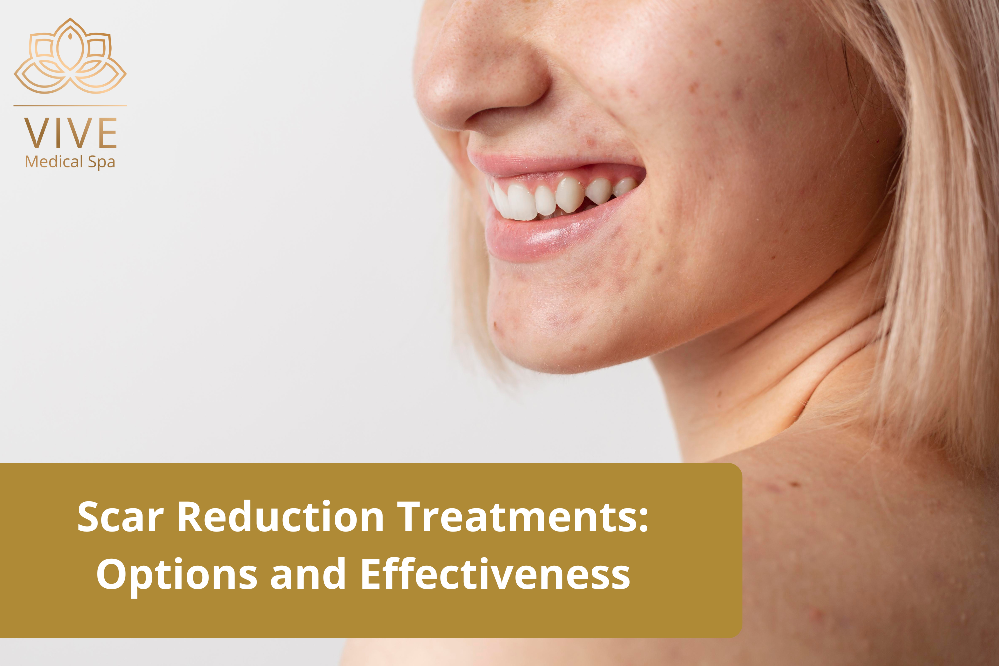 Scar Reduction Treatments: Options and Effectiveness